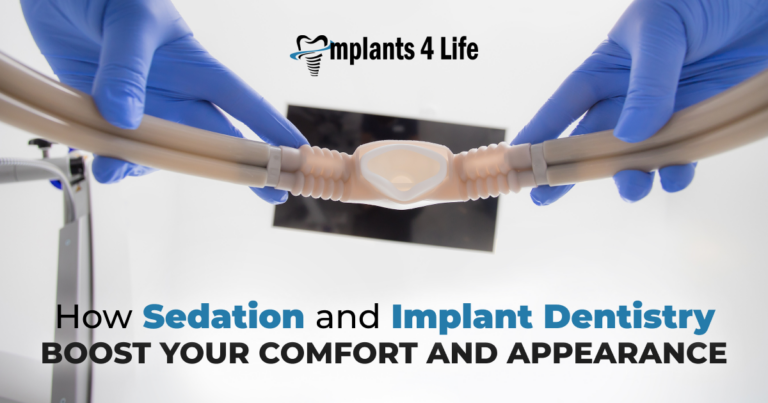 How Sedation and Implant Dentistry Boost Your Comfort and Appearance
