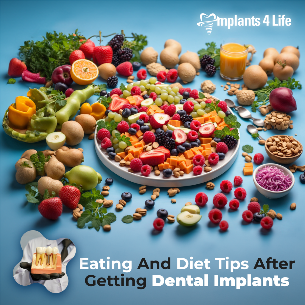 Eating and Diet Tips After Getting Dental Implants - Implants 4 Life