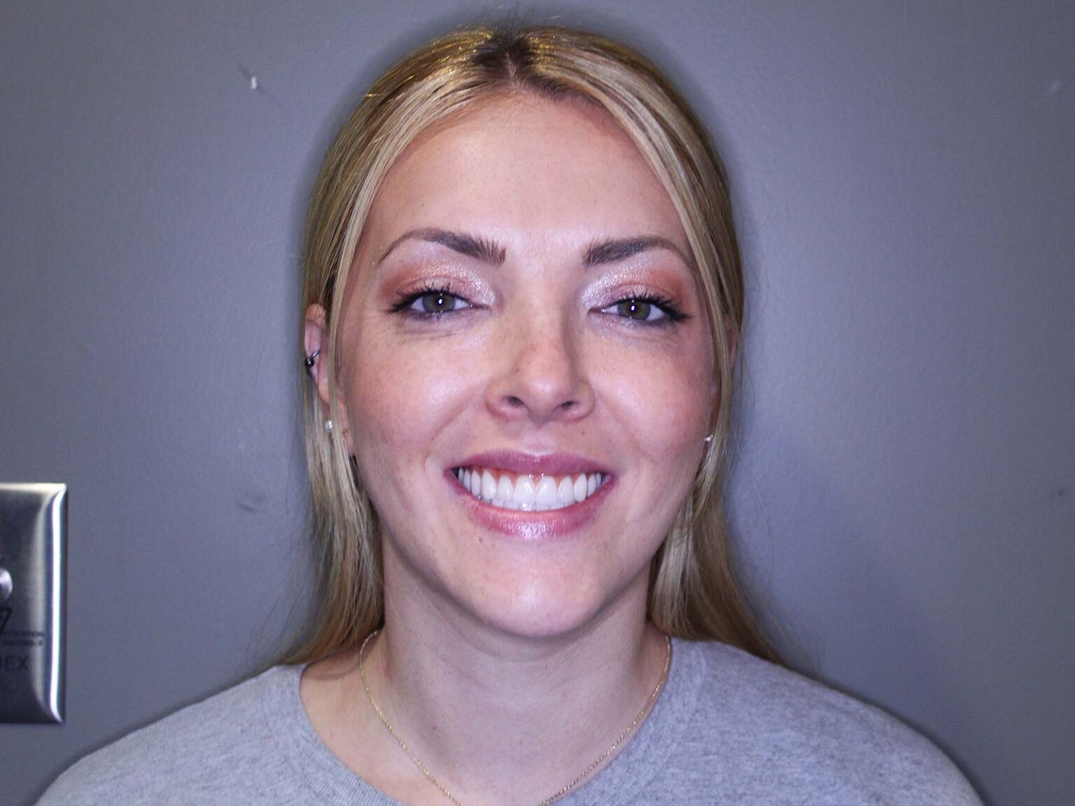 Implants 4 Life: Dental Implants in Sherman Oaks, Santa Clarita & Chino